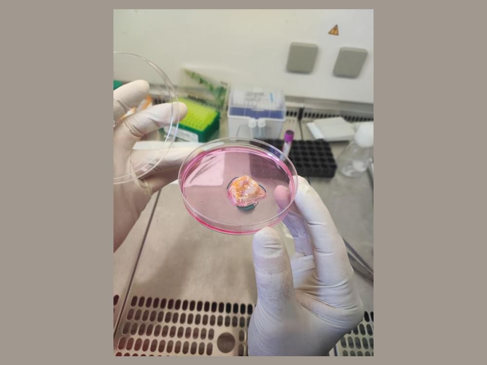 Abu Dhabi Stem Cells Centre pioneers groundbreaking cancer therapy ...